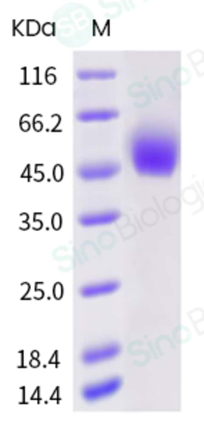 Sino Biological SIRP alpha Protein, Human, Recombinant (ECD, SIRP ...