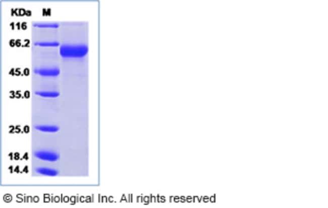 Sino Biological Influenza A H4N2 (A/duck/Hunan/8-19/2009) Hemagglutinin ...