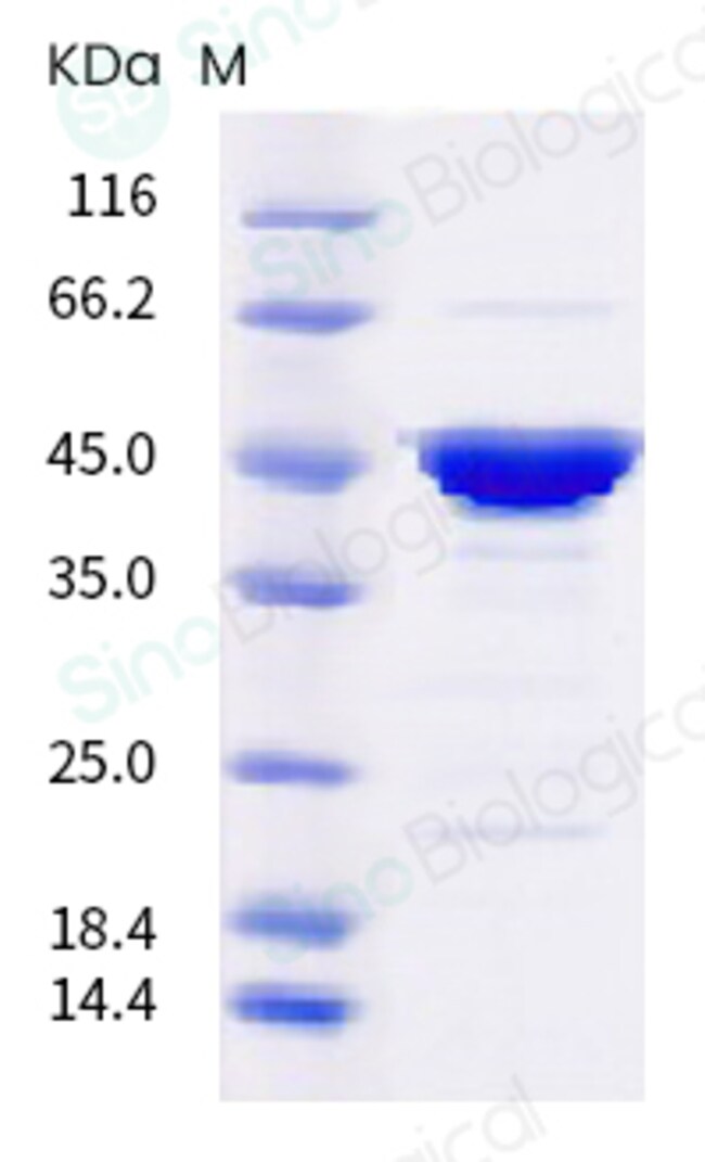 Sino Biological SARS-CoV-2 Nucleocapsid (P67S) Protein (His Tag) 100ug ...