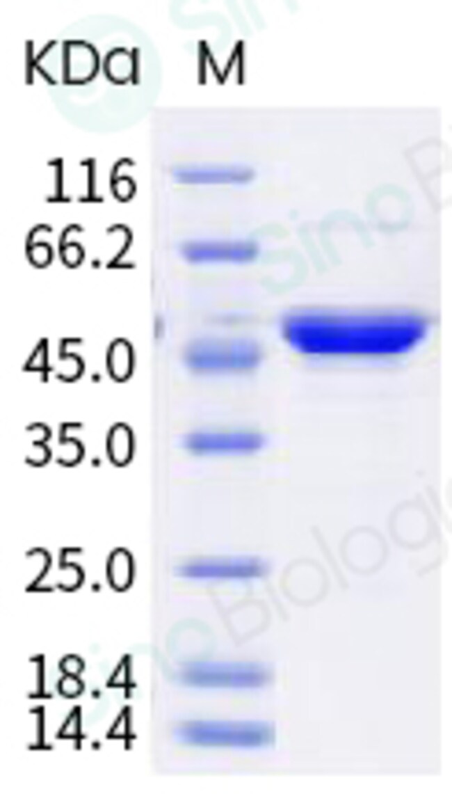 Sino Biological SARS-CoV-2 Nucleocapsid (R203M, D377Y) Protein (His Tag ...
