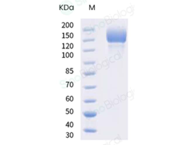 Sino Biological SARS-CoV-2 B.1.617.1 Spike S1+S2 trimer Protein (ECD ...