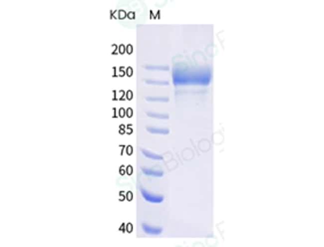 Sino Biological SARS-CoV-2 (AY.4.2) Spike S1+S2 trimer Protein ( ECD ...