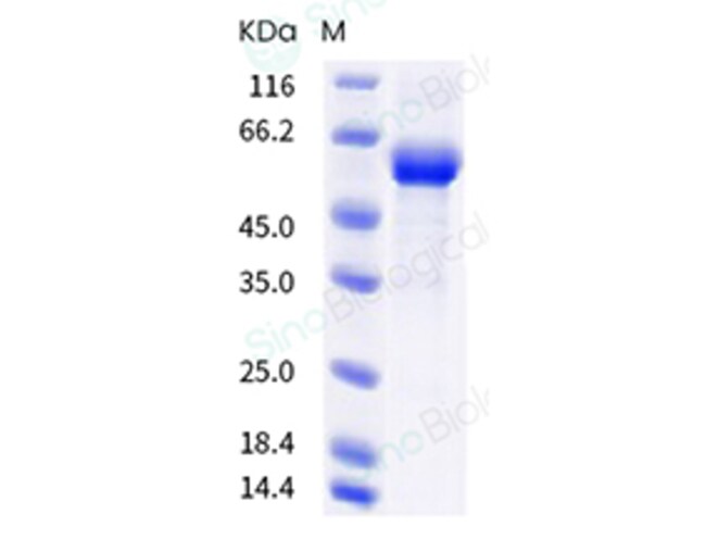 Sino Biological SARS-CoV-2 Spike RBD (K417N, E484K, N501Y) Protein (Fc ...