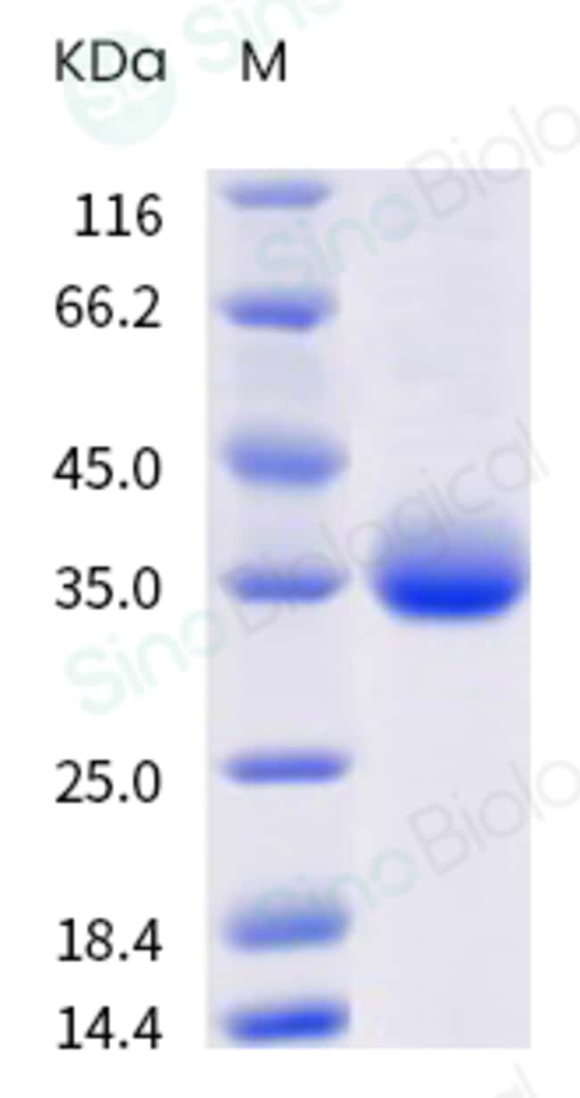Sino Biological SARS-CoV-2 Spike RBD (E484K, N501Y) Protein (His Tag ...