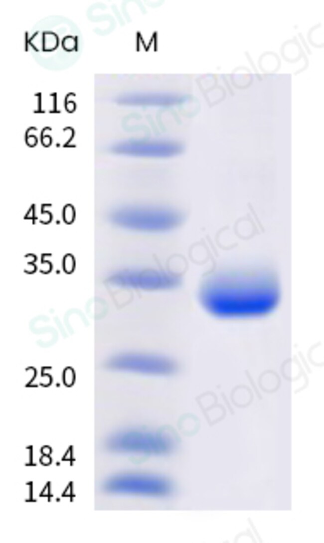 Sino Biological SARS-CoV-2 Spike RBD (K417N, L452R, T478K) Protein (His ...