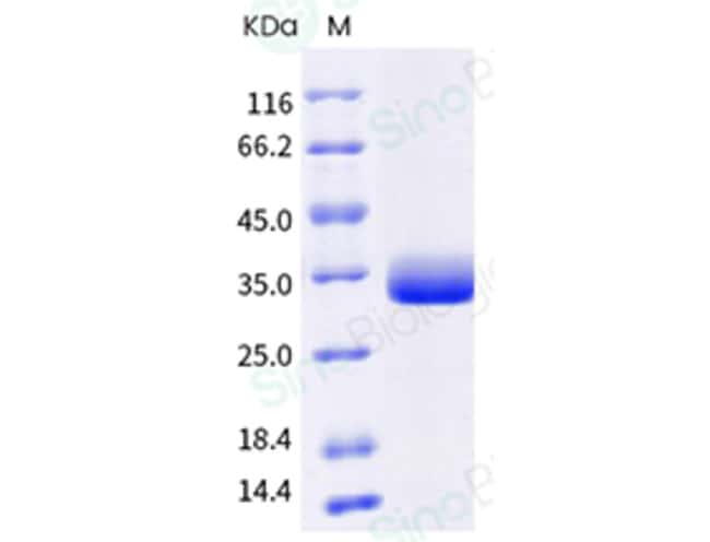 Sino Biological SARS-CoV-2 (B.1.640) Spike RBD Protein (His Tag) 100ug ...