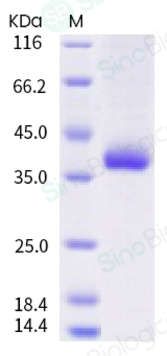 Sino Biological SARS-CoV-2 (2019-nCoV) Spike RBD(N439K)-His Recombinant ...