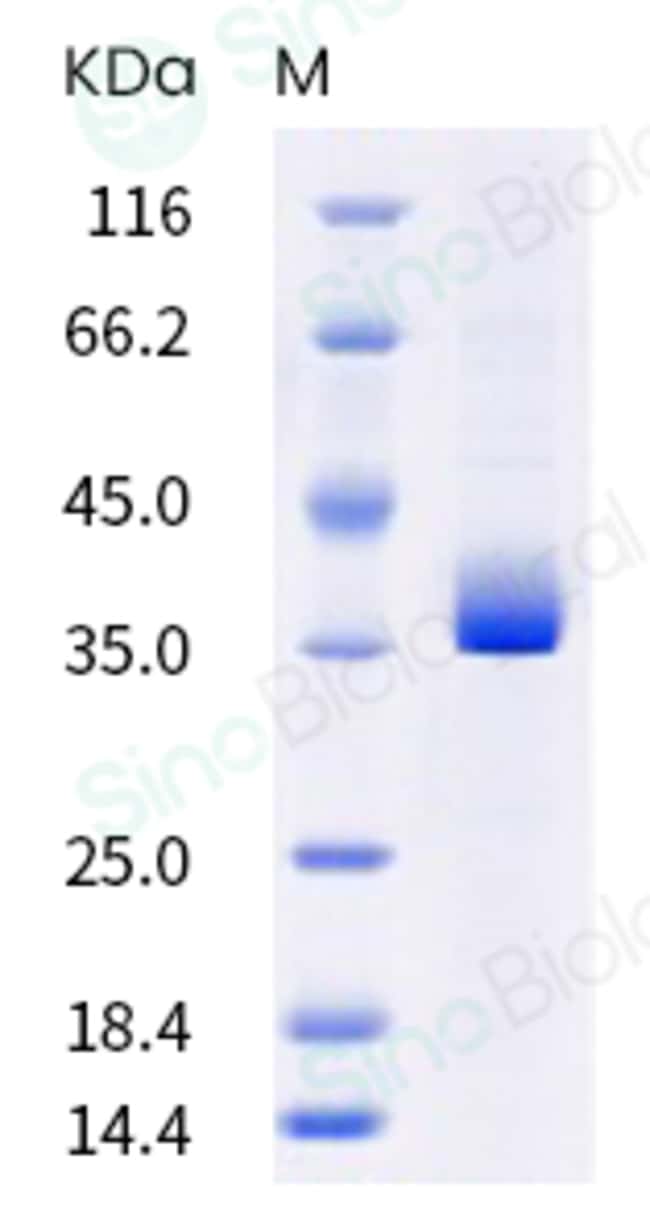 Sino Biological SARS-CoV-2 Spike RBD (K417N, E484K, N501Y) Protein (His ...