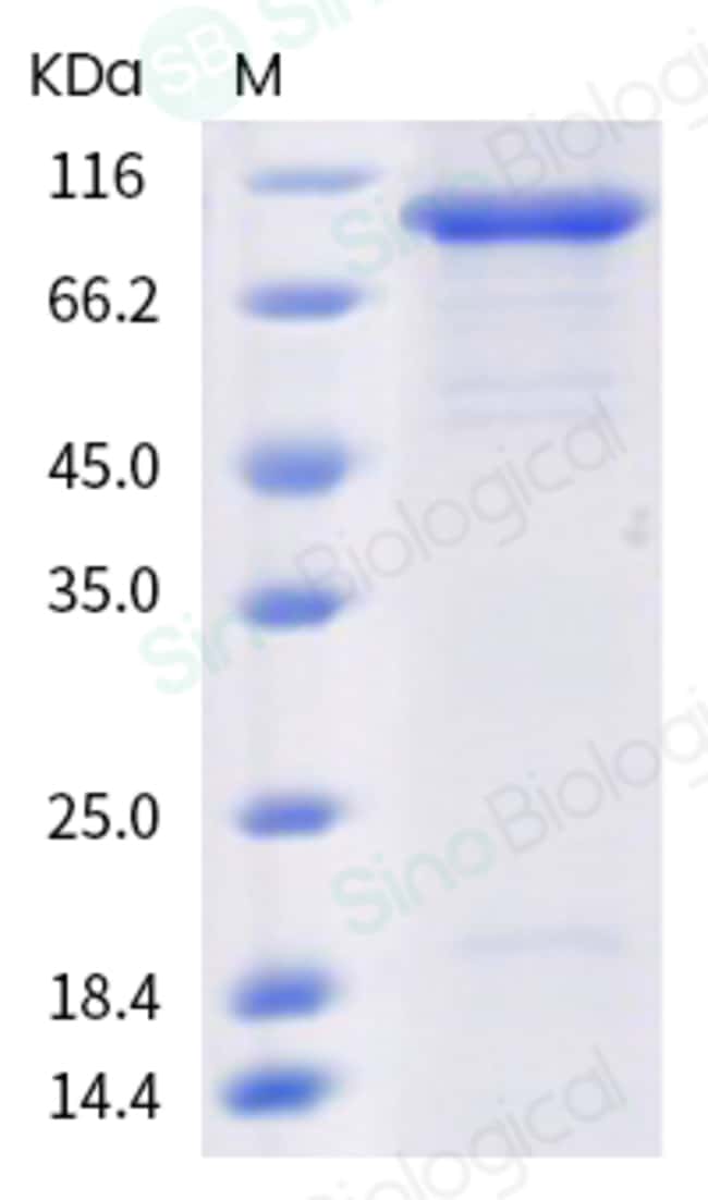 Sino Biological SARS-CoV-2 (2019-nCoV) RNA-dependent RNA polymerase ...