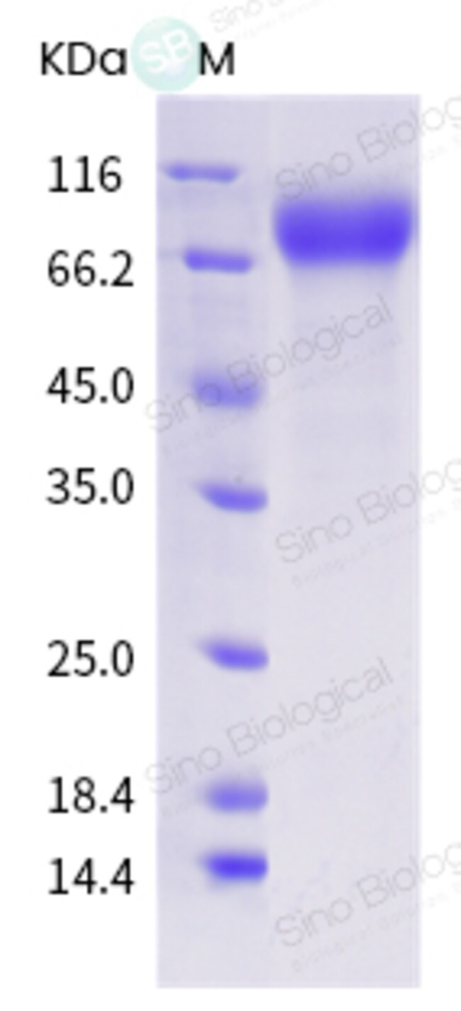 Sino Biological Influenza A H1N2 (A/swine/North Carolina/01169/2006 ...