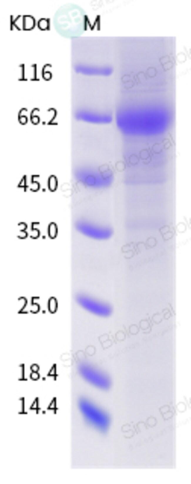 Sino Biological Influenza A H1N2 (A/swine/Alberta/SD0217/2017 ...