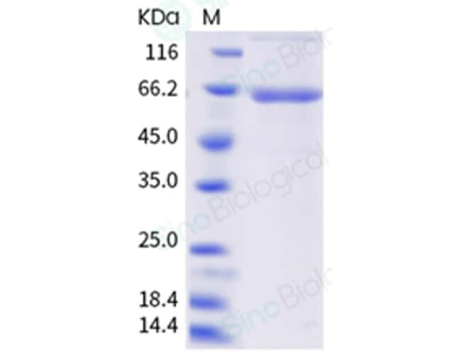 Sino Biological Human parainfluenza 3 virus (HPIV-3) (strain Wash/47885 ...