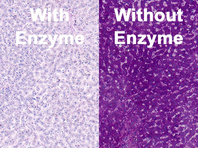 Newcomer Supply Periodic Acid Schiff (PAS) Glycogen Control Slides, 98 ...