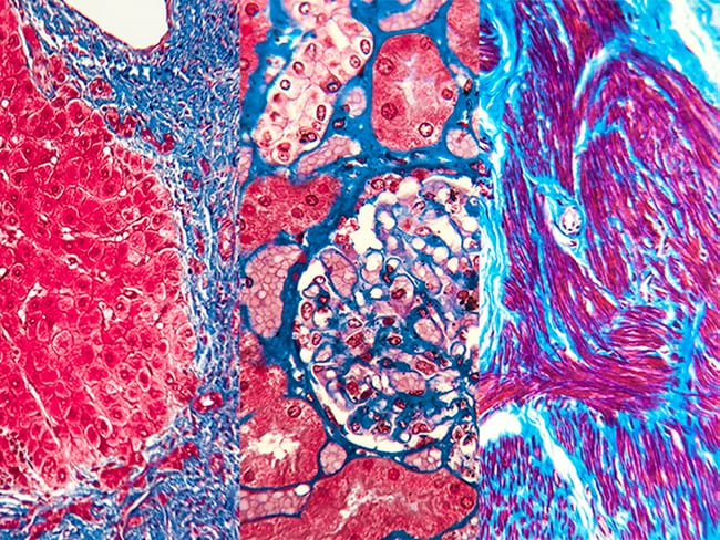 Newcomer Supply Trichrome, Multi-Tissue Control Slides, 10/set ...