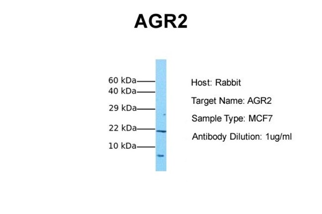 Aviva Systems Biology Corp AGR2 Antibody - middle region (ARP42290_P050) | Fisher Scientific