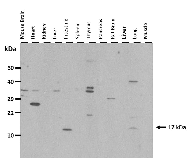 Aviva Systems Biology Corp MYL6 Antibody - middle region (ARP57712_P050 ...