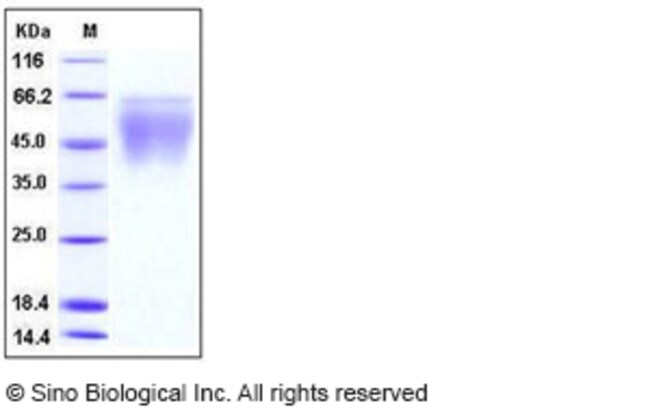 Sino Biological Mouse CD86 / B7-2 Protein (His Tag) 1mg, Quantity: Each ...