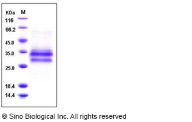 Sino Biological IL25 Protein, Mouse, Recombinant (His Tag) 1mg | Fisher ...