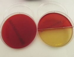 Oxyrase Oxypras 2-Pack: Bbe/Kvl Bi-Plate, Brucella 10/Pk, Quantity ...