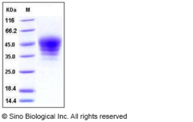 Sino Biological Mouse SLAMF7 / CRACC Protein (His Tag) 1mg, Quantity ...