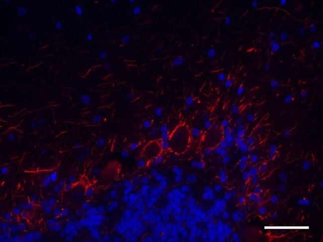 Biolegend Alexa Fluor 594 anti-Neurofilament L (NF-L) | Fisher Scientific