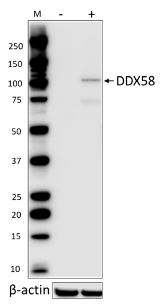 Biolegend Purified anti-DDX58 (RIG-I), Quantity: Each of 1 | Fisher ...