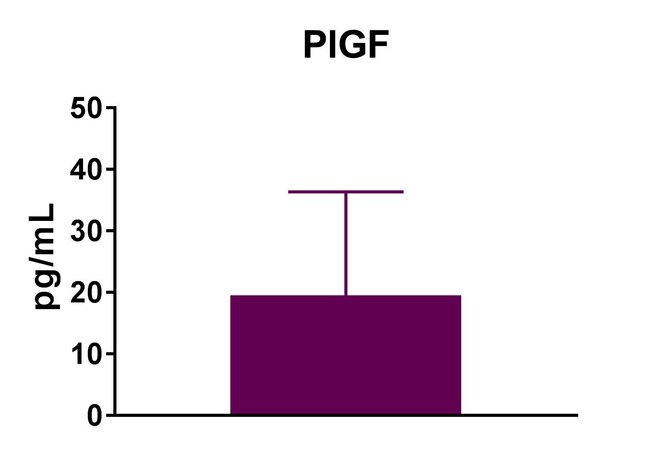 Biolegend LEGENDplex Human PlGF Capture Bead B4, 13X, Quantity: Each of ...