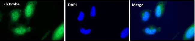 Abcam Zinc Assay Kit (Cell-based) 50test, Quantity: Each of 1 | Fisher ...