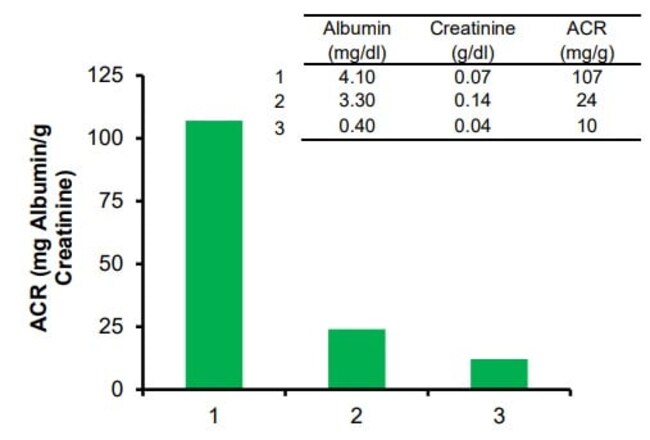 Abcam Albumin Creatinine Ratio Assay Kit, Quantity: Each of 1 | Fisher ...