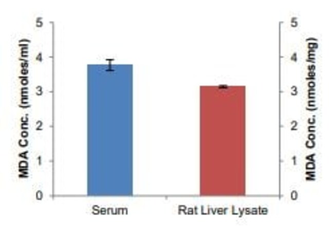 Abcam Lipid Peroxidation Colorimetric Assay Kit 96test, Quantity: Each ...