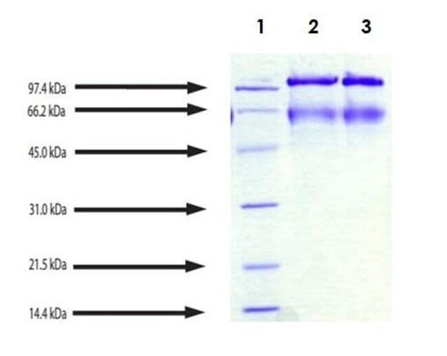 Abcam Native Human HMW Kininogen protein 100ug, Quantity: Each of 1 ...