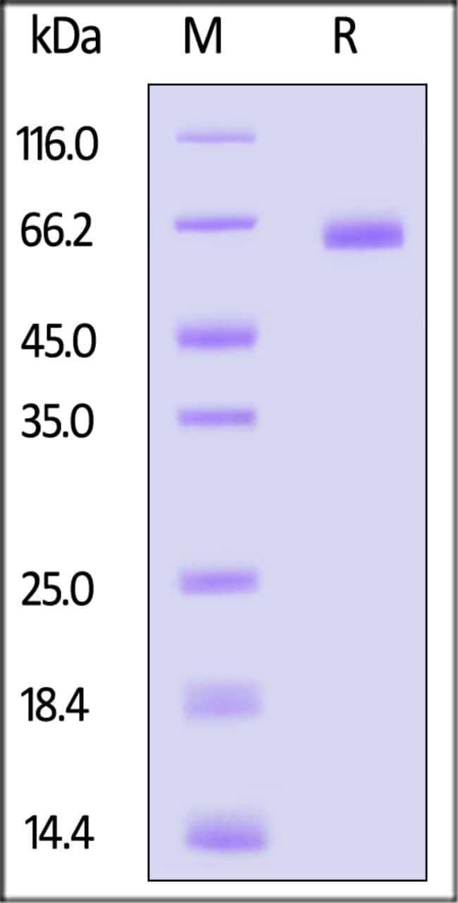 ACROBiosystems Mouse MMP-8, His Tag (MM8-M52H8) is expressed from human ...