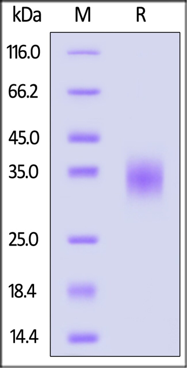 ACROBiosystems Human LAMP-5, His Tag (LA5-H52H9) is expressed from ...