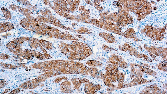 Diagnostic Biosystems CA 15-3, Quantity: Each of 1 | Fisher Scientific