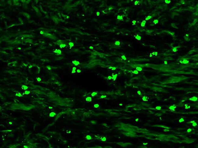 Diagnostic Biosystems Kappa Light Chain-CF488, Quantity: Each of 1 ...