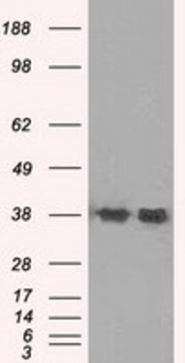OriGene Sorbitol Dehydrogenase (SORD) Mouse Monoclonal Antibody [Clone ...