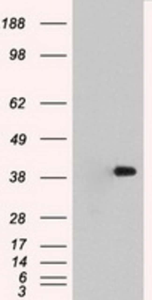 OriGene ERK2 (MAPK1) Mouse Monoclonal Antibody [Clone ID: OTI1D3], Quantity: | Fisher Scientific