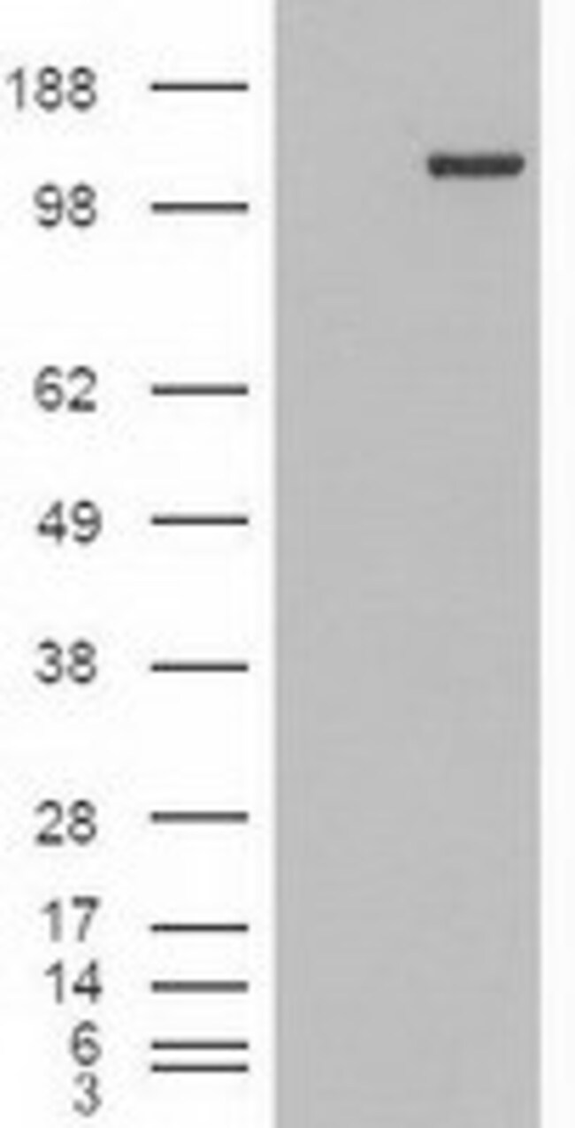 OriGene TIF1 gamma (TRIM33) Mouse Monoclonal Antibody [Clone ID: OTI6B7 ...