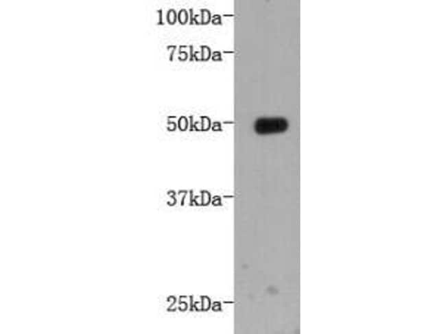 HUABIO RESEARCH INC Anti-LRP-1 Antibody [A4-F5], Quantity: Each of 1 | Fisher Scientific