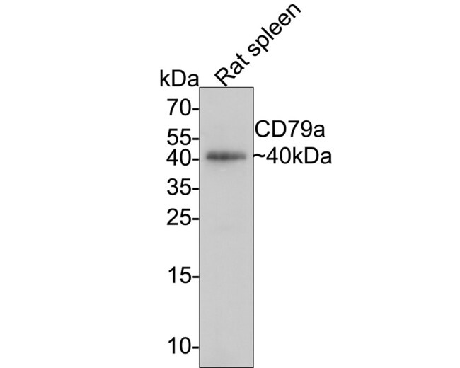 HUABIO RESEARCH INC Anti-CD79a Antibody [C1-E8], Quantity: Each of 1 ...