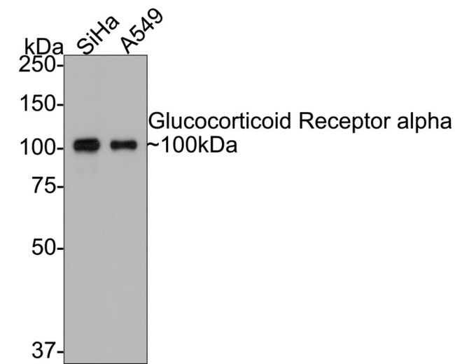 HUABIO RESEARCH INC Anti-Glucocorticoid Receptor alpha Antibody [3F2 ...