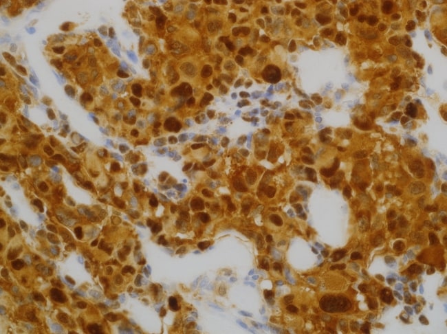 Leica Biosystems 7ML (4C4.9 MAB) S100 Protein ', Quantity: Each of 1 ...