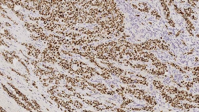 Leica Biosystems 1ml NCL-L-p53-DO7, Quantity: Each of 1 | Fisher Scientific