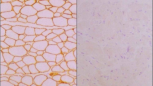 Leica Biosystems 1ml NCL-MEROSIN, Quantity: Each of 1 | Fisher Scientific