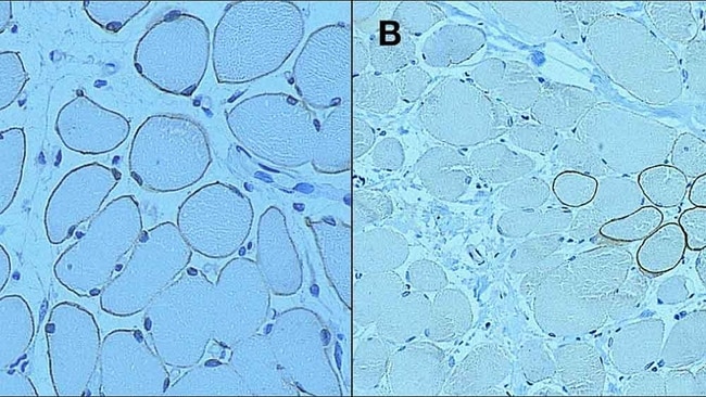 Leica Biosystems 1ml NCL-DYSA, Quantity: Each of 1 | Fisher Scientific
