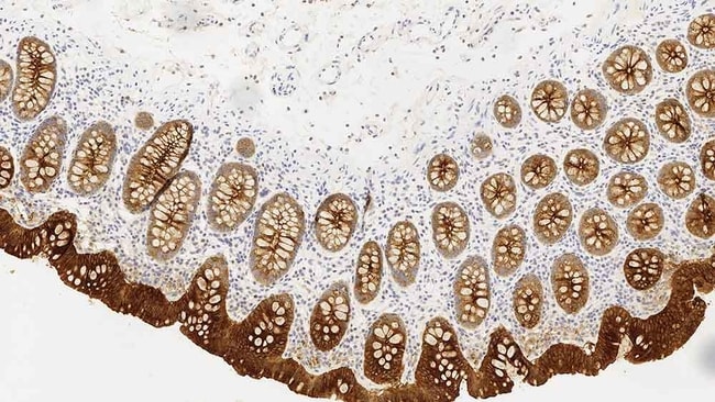 Leica Biosystems 1ml NCL-L-CEA-2, Quantity: Each of 1 | Fisher Scientific