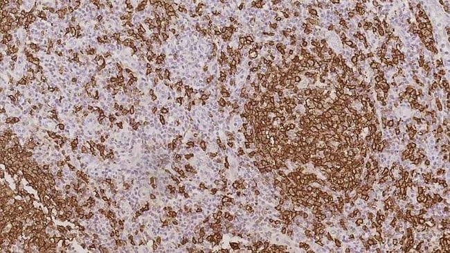 Leica Biosystems 1ml NCL-L-CD20-L26, Quantity: Each of 1 | Fisher ...