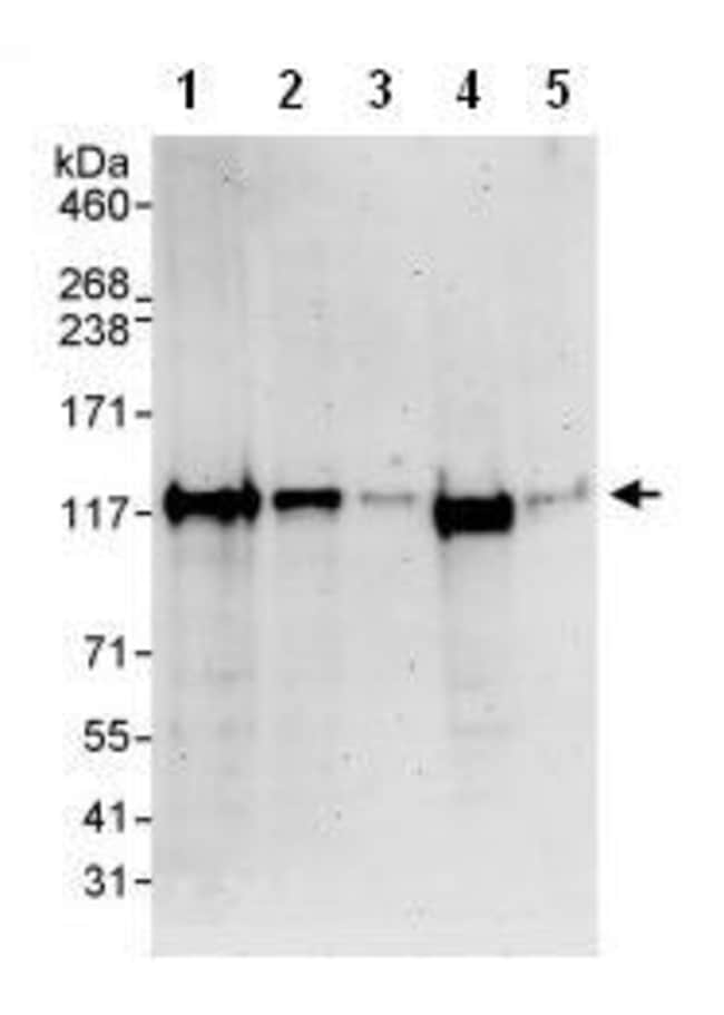 Abcam Anti-Spa-1 antibody., Quantity: Each of 1 | Fisher Scientific