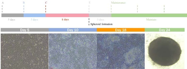 ACROBiosystems Ready-to-use Human iPSC-Derived Liver Organoids ...