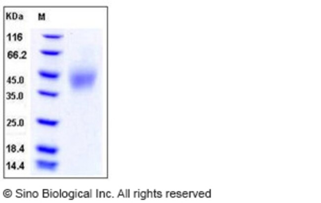 Sino Biological Mouse SLAMF6 / Ly108 Protein (His Tag) 1mg, Quantity ...